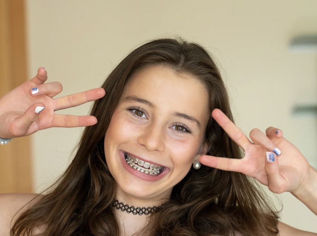 What Will I Look Like With Braces A Guide To Braces Types Benefits